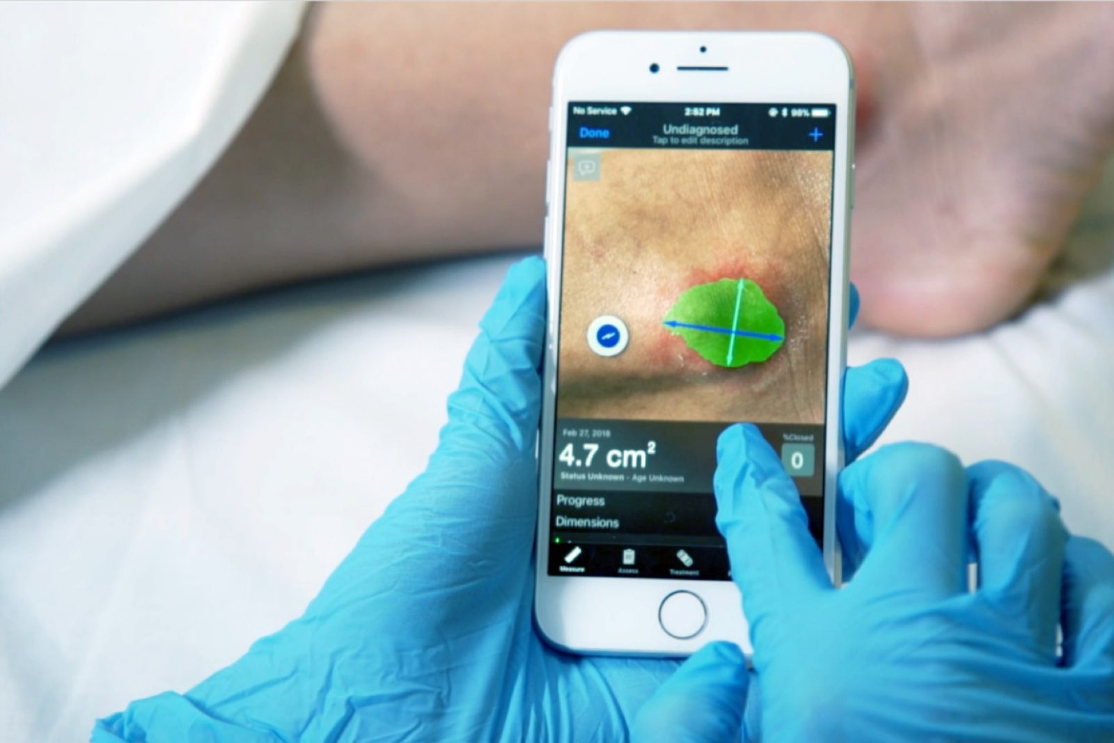 Why Wound Care? - Swift