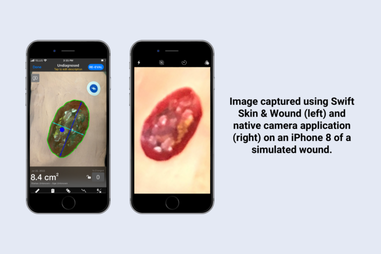 The ROI of Digital Wound Care - Swift