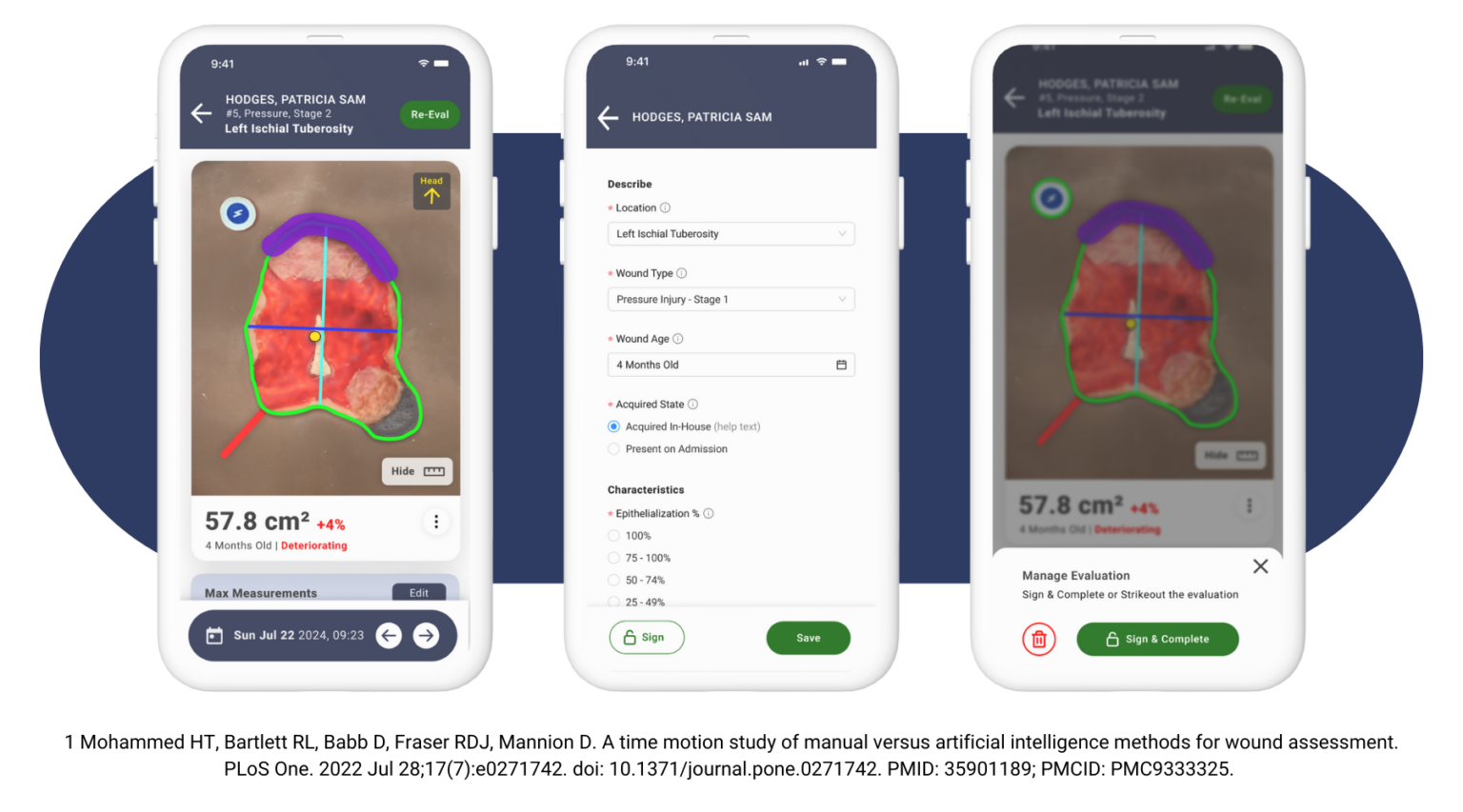 Swift Skin and Wound Mobile App and Dashboards - Swift